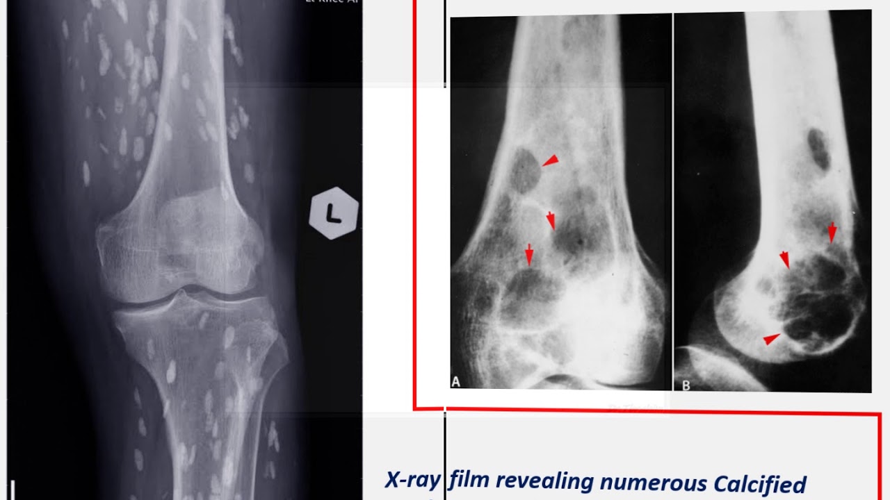elective course media ( imaging of parasites) - YouTube
