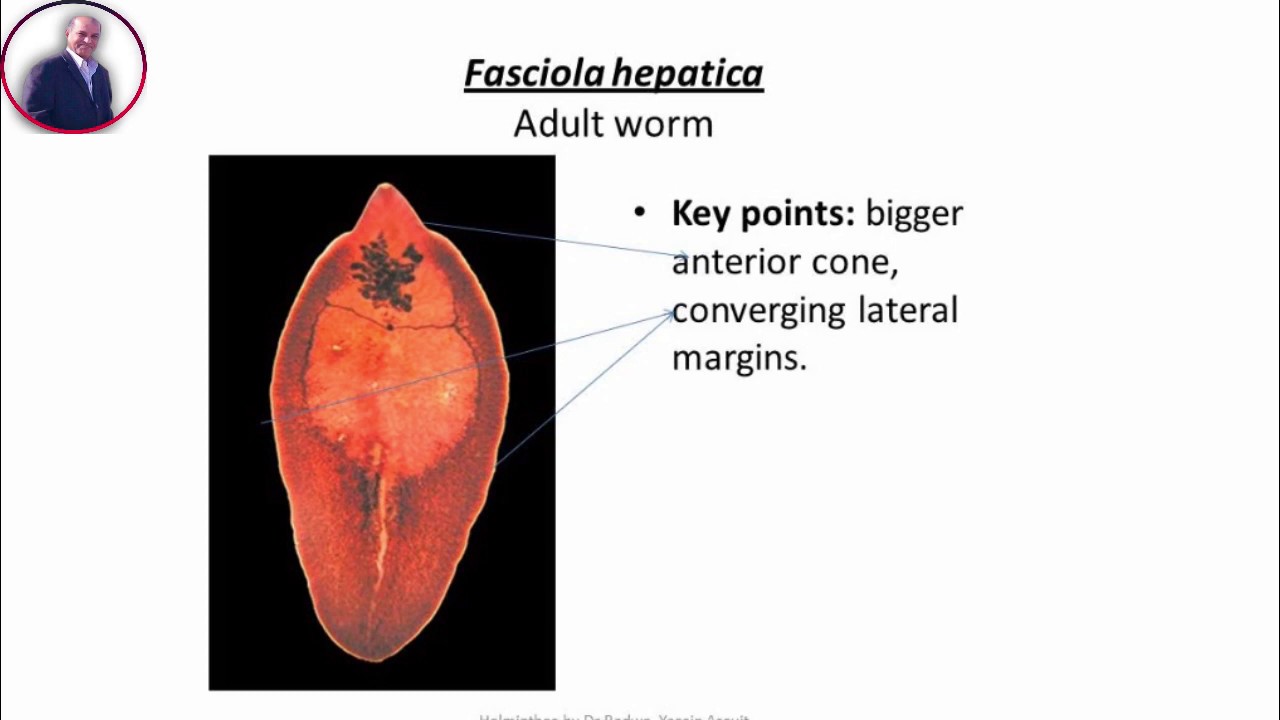 1- Laboratory Section of Trematodes - YouTube