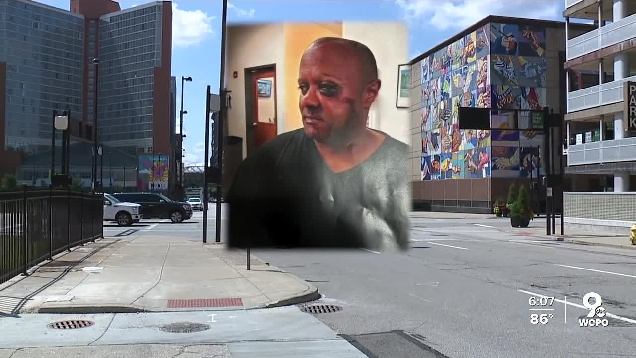 FOP president: Cincinnati officer needs reconstructive surgery after ...