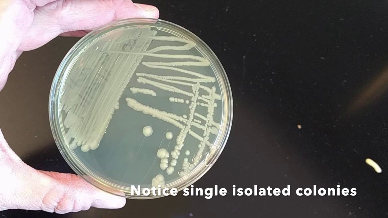 Staphylococcus Epidermidis Streak Plate