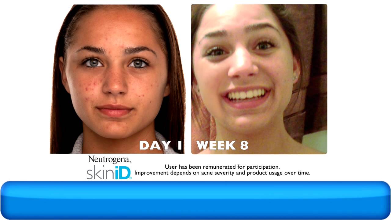 Neutrogena SkinID Commercial - YouTube