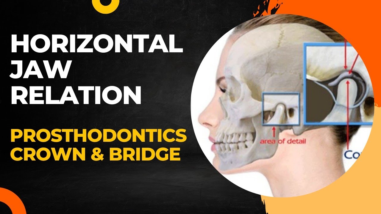 Methods of Horizontal Jaw Relation in Complete Denture - YouTube
