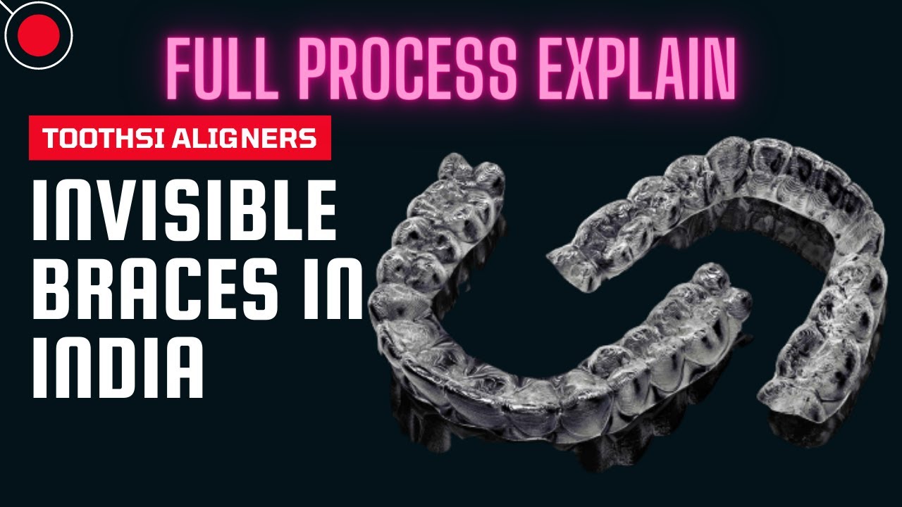 Toothsi Invisible Braces Full Process by Toothsi Aligners | Straighten ...