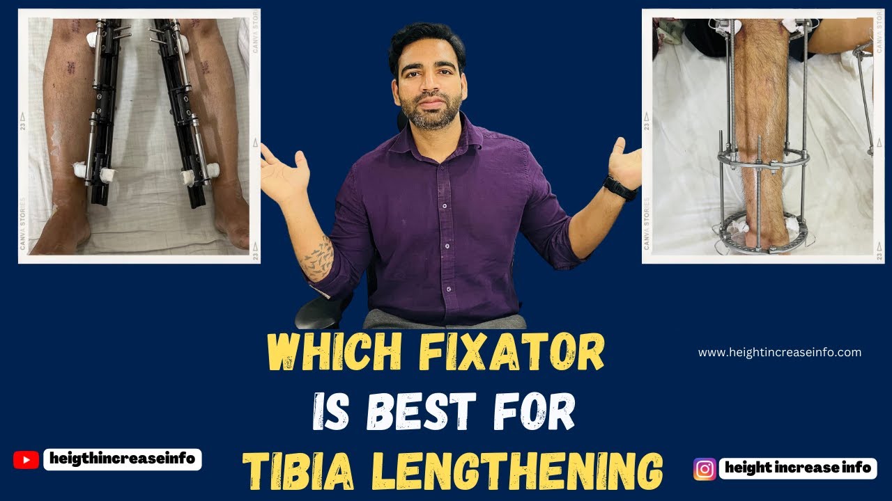 Which fixator is best for Tibia Lengthening #limblengtheningsurgery # ...