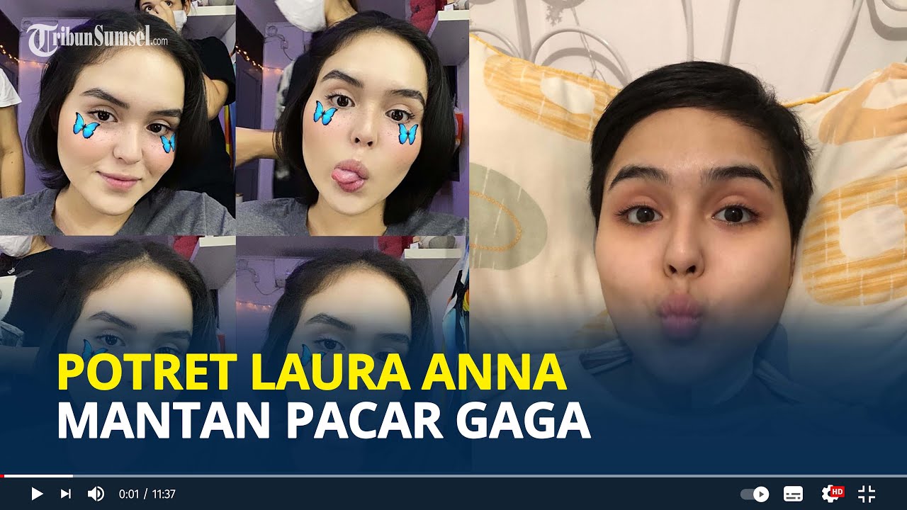 7 Potret Laura Anna, Mantan Pacar Gaga yang Lumpuh Akibat Kecelakaan ...
