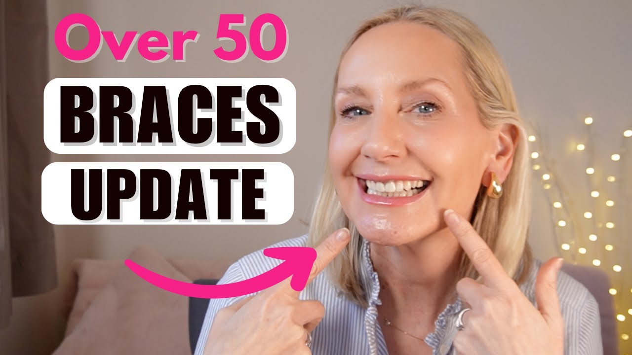 *BRACES OVER 50? (SHOULD YOU DO IT?) - YouTube