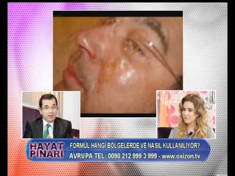 HAYAT PINARI 3 SAMANYOLU TV KONUK