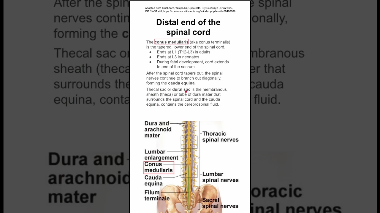Spinal Cord Cauda Vs Conus Cauda Equina Syndrome REBEL EM