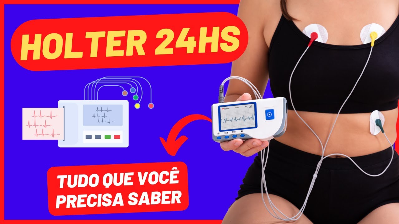 EXAME DE HOLTER 24 HORAS | O QUE É | PARA QUE SERVE | COMO DEVE SER REALIZADO | EXAME DE LOOPER ...