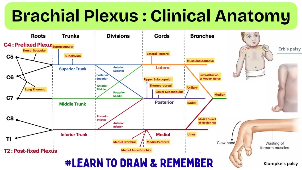 Brachial Plexus Anatomy | Easy Way to Draw | Erb's Palsy, Klumpke's Palsy| USMLE, PLAB, NURSING ...