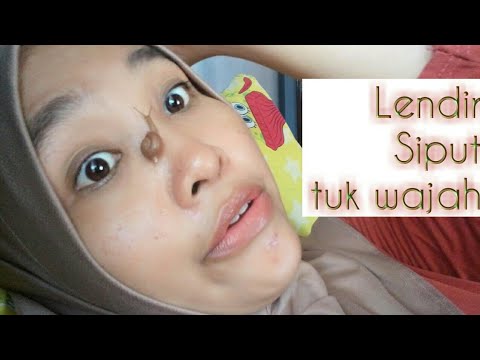 Treatment lendir siput//kecantikan