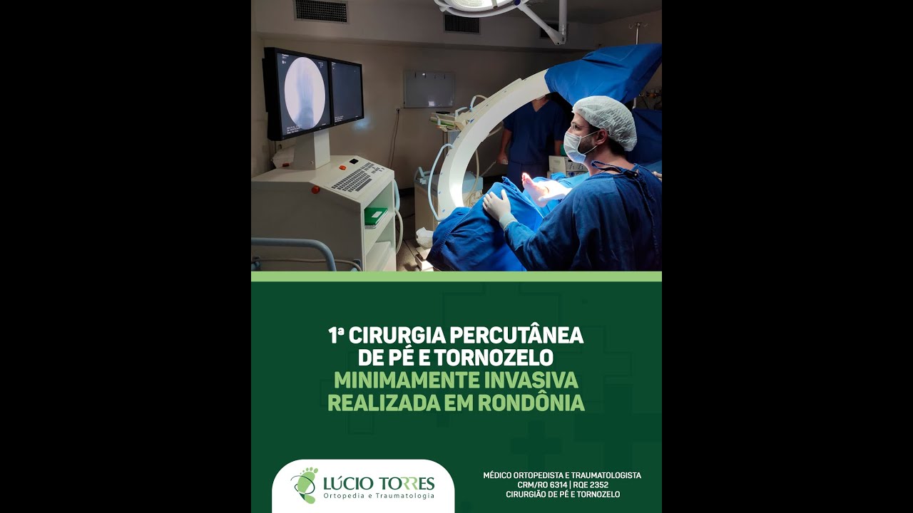 Dr. Lucio Torres - 1ª Cirurgia percutânea de pé e tornozelo minimamente ...