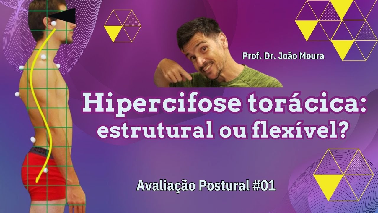 HIPERCIFOSE TORÁCICA ESTRUTURAL OU FLEXÍVEL, COMO IDENTIFICAR ...