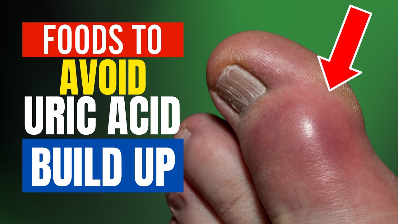 Foods To Avoid Uric Acid Build Up (Proven!) - YouTube