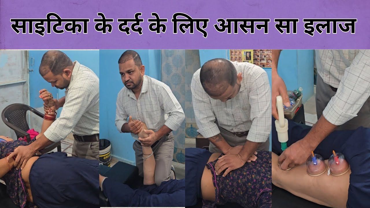 Sciatica problem treatment | Sciatica pain treatment - YouTube