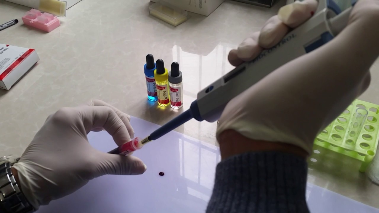 Groupage par la methode de BETH VINCENT - YouTube