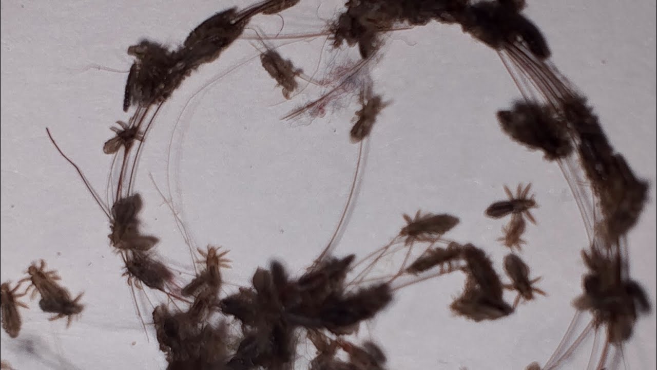 Remove all thousand lice from her hair_pick out all of big lice from ...