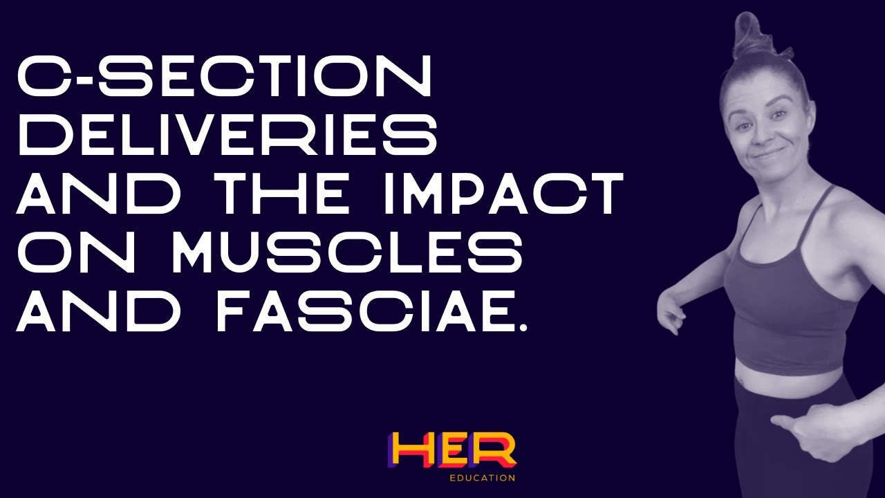 C-section deliveries and the impact on muscles and fasciae. - YouTube
