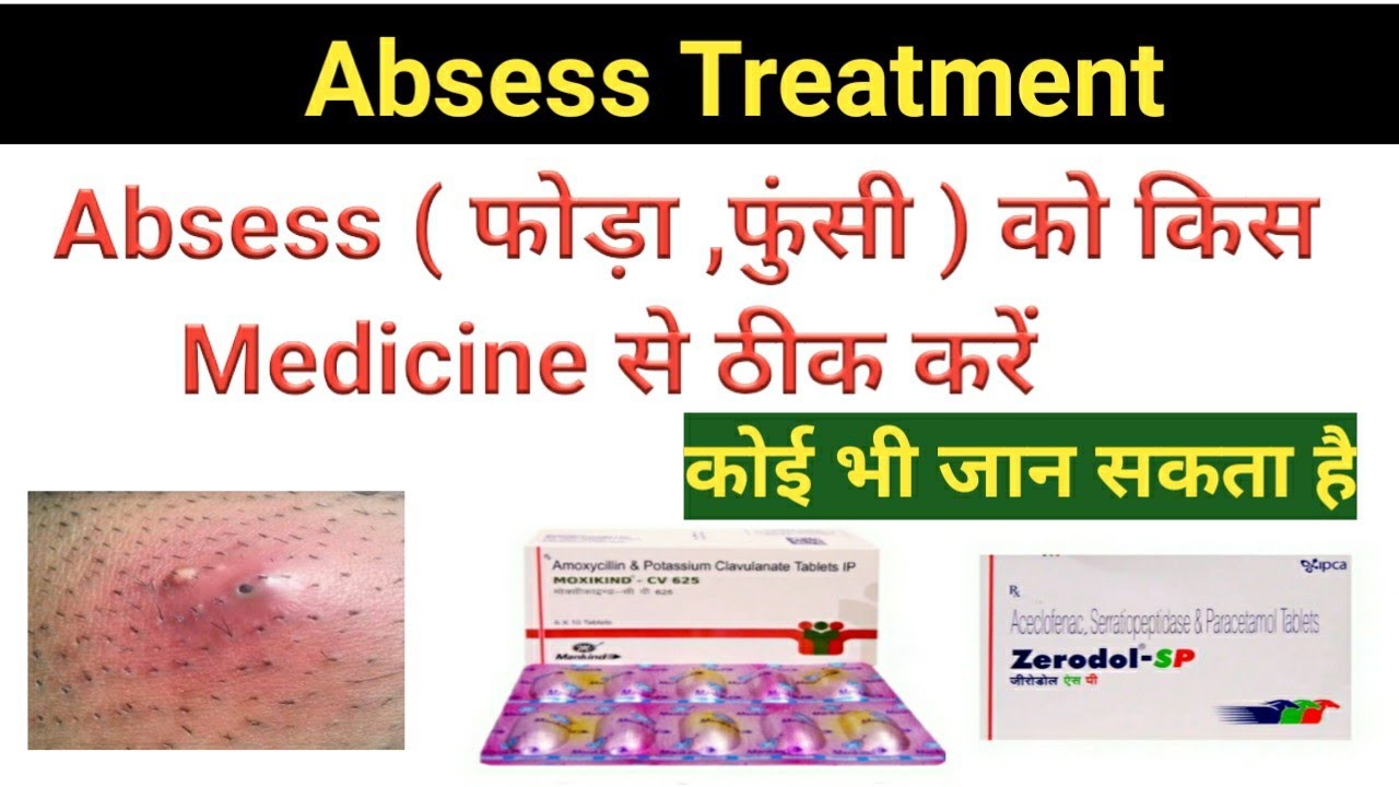 Absess ( फोड़ा , फुंसी , घाव ) को किस medicine से ठीक करें - YouTube