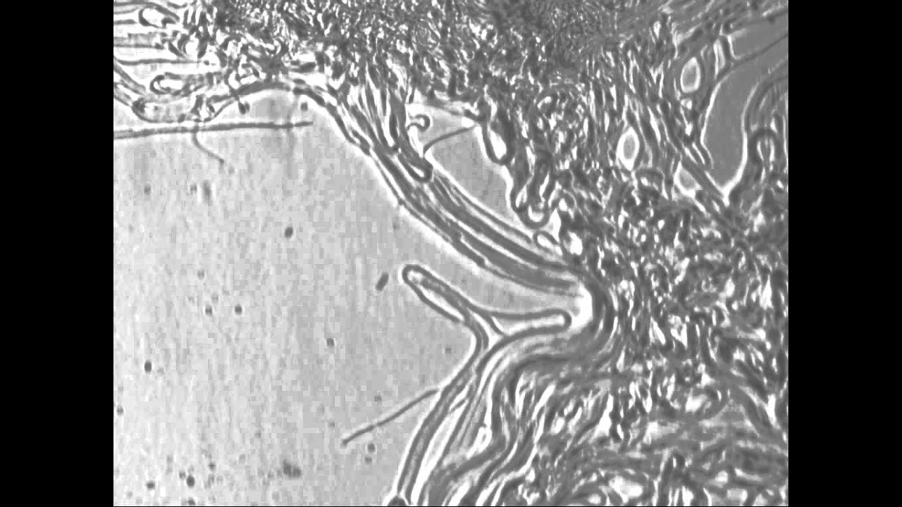Time lapse recording growth Bacillus mycoides 30012012 - YouTube