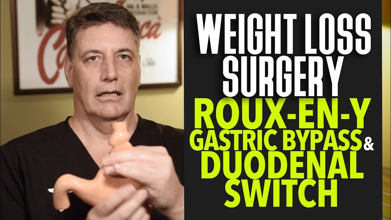 Roux En Y Gastric Bypass Before After