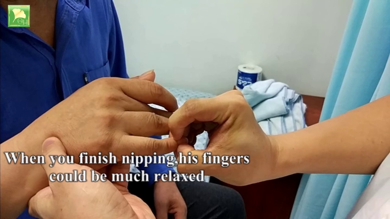 Li-lin Pointing Therapy for Sequelae of Cerebral Hemorrhage - YouTube