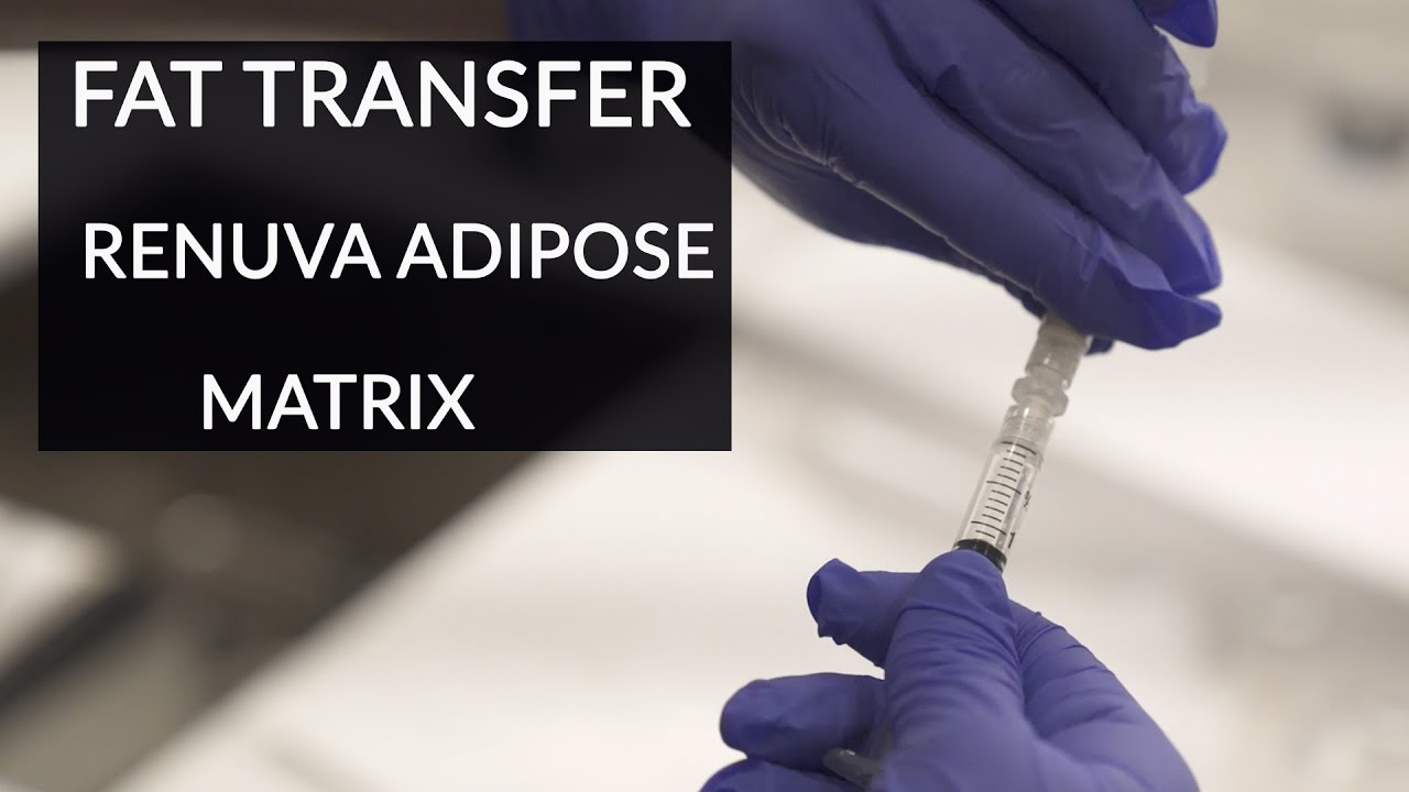 Fat Transfer with Donor Fat | Renuva Adipose Matrix | Beverly Hills ...