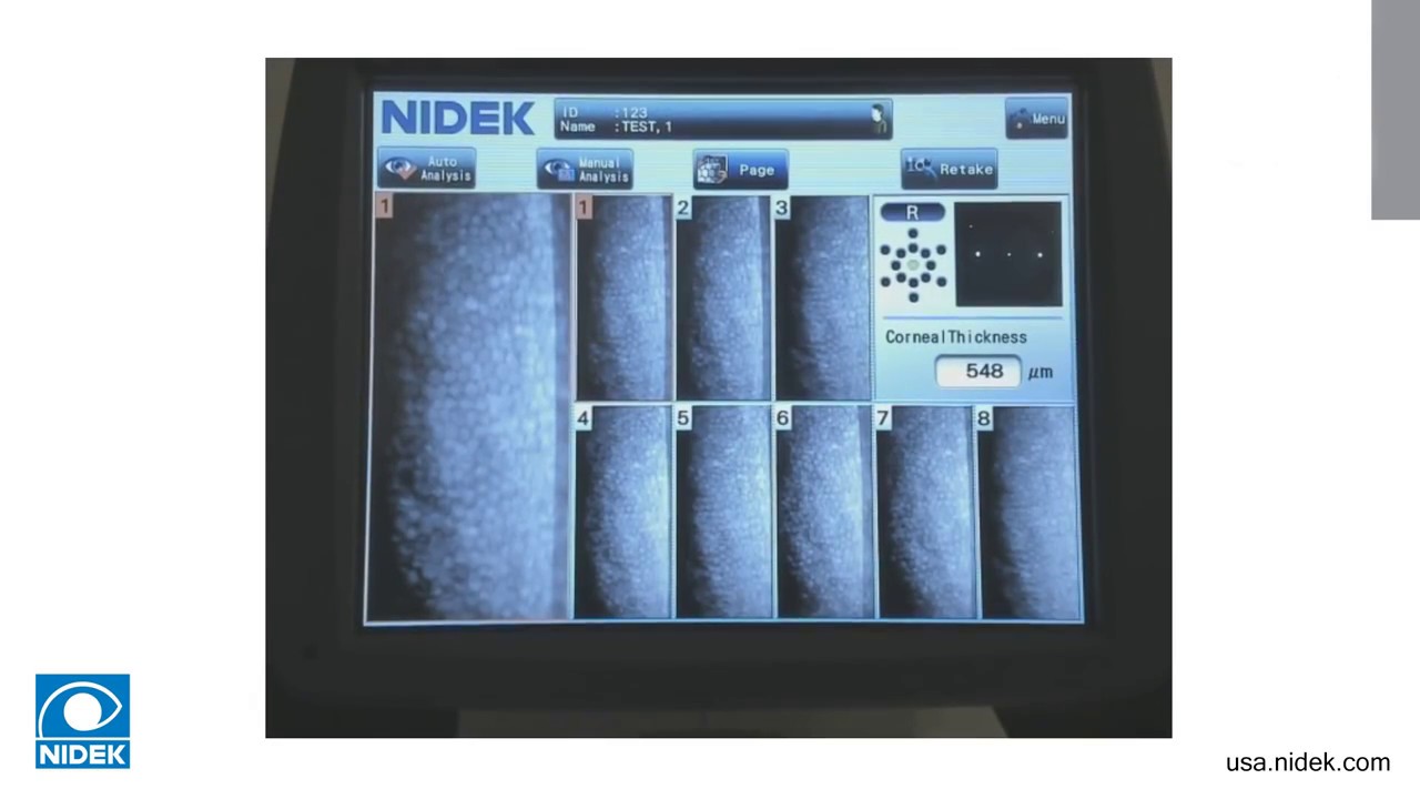 NIDEK CEM-530 Specular Microscope | Product Training - YouTube