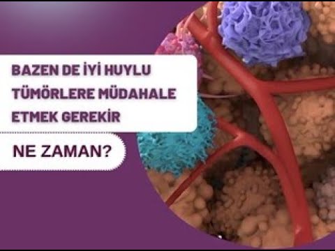 İyi Huylu Tümör Nedir?