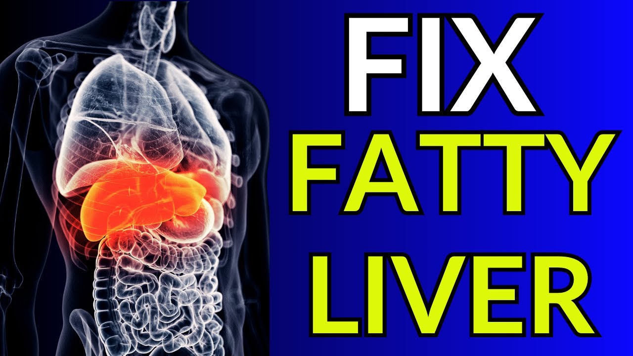 12 Steps to Reverse Fatty Liver | Cure Fatty Liver - YouTube