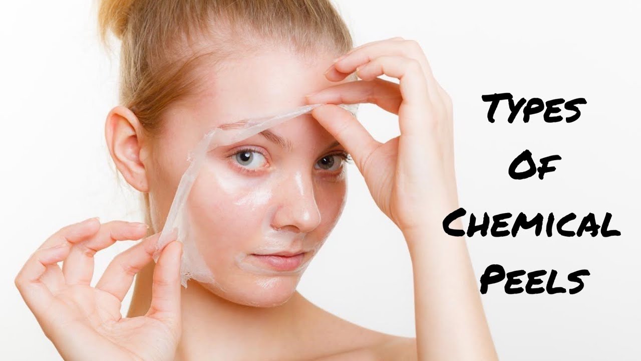 Understanding The Types of Chemical Peels - YouTube