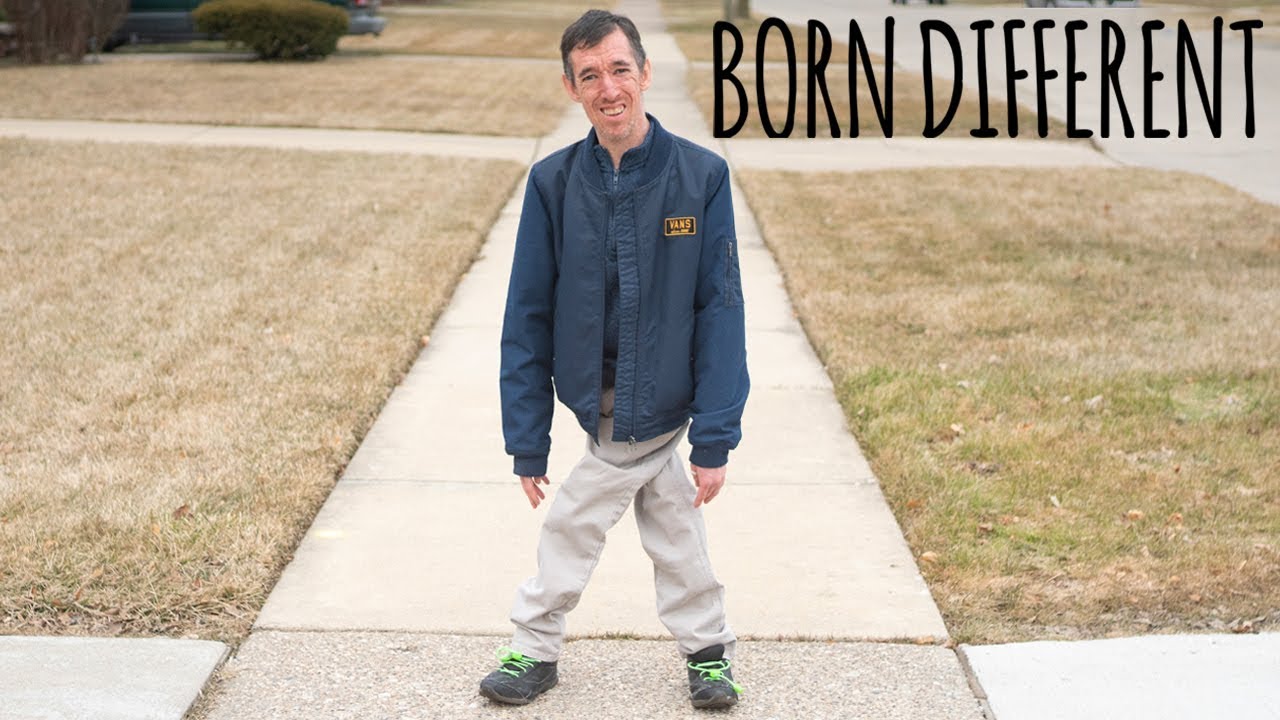 The Incredible Man With Legs Like Scissors | BORN DIFFERENT - YouTube