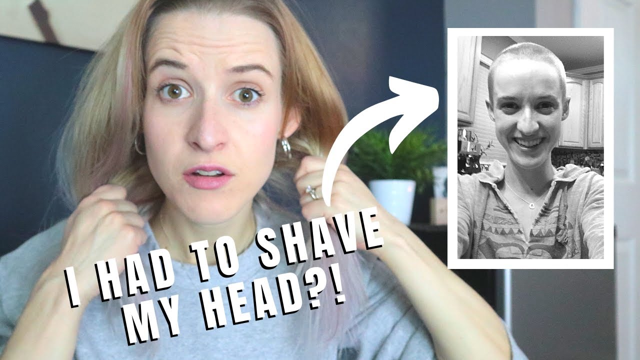 A Doctor Made Me SHAVE MY HEAD for No Reason?! 👨🏻‍🦲 | Storytime ...