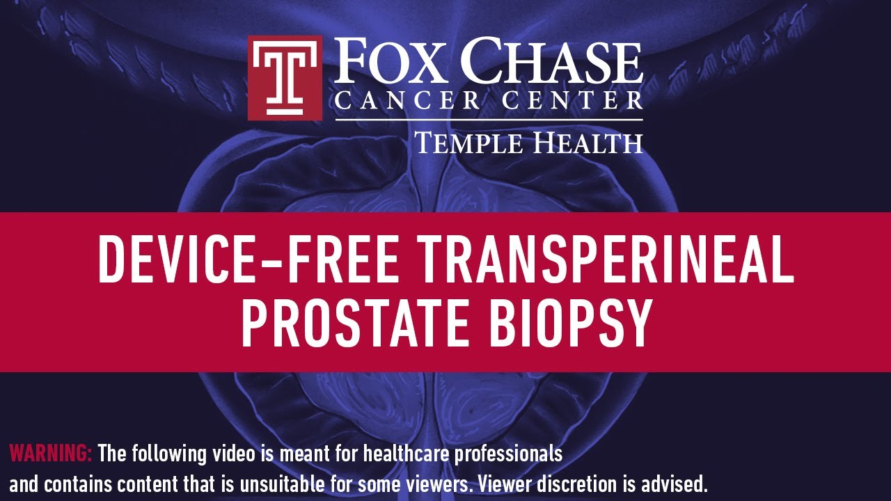 How to Perform Device-Free, Free-Handed Transperineal Prostate Biopsy ...