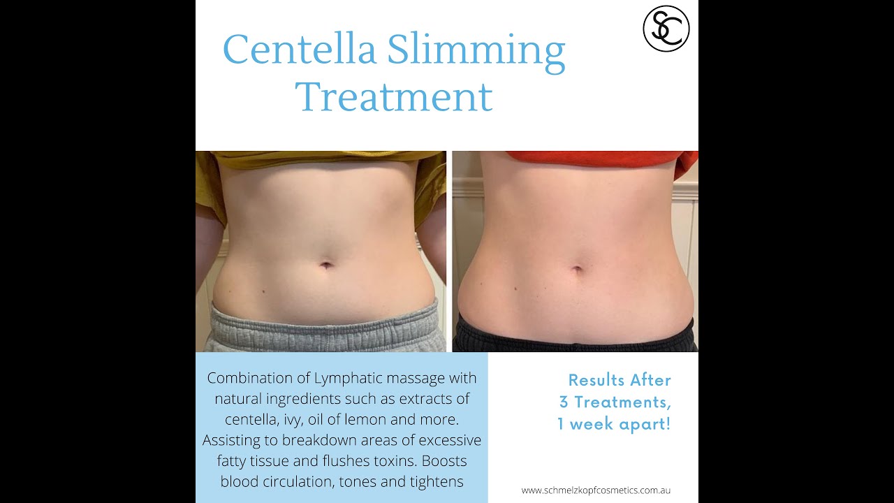 Centella Slimming Training Video - YouTube