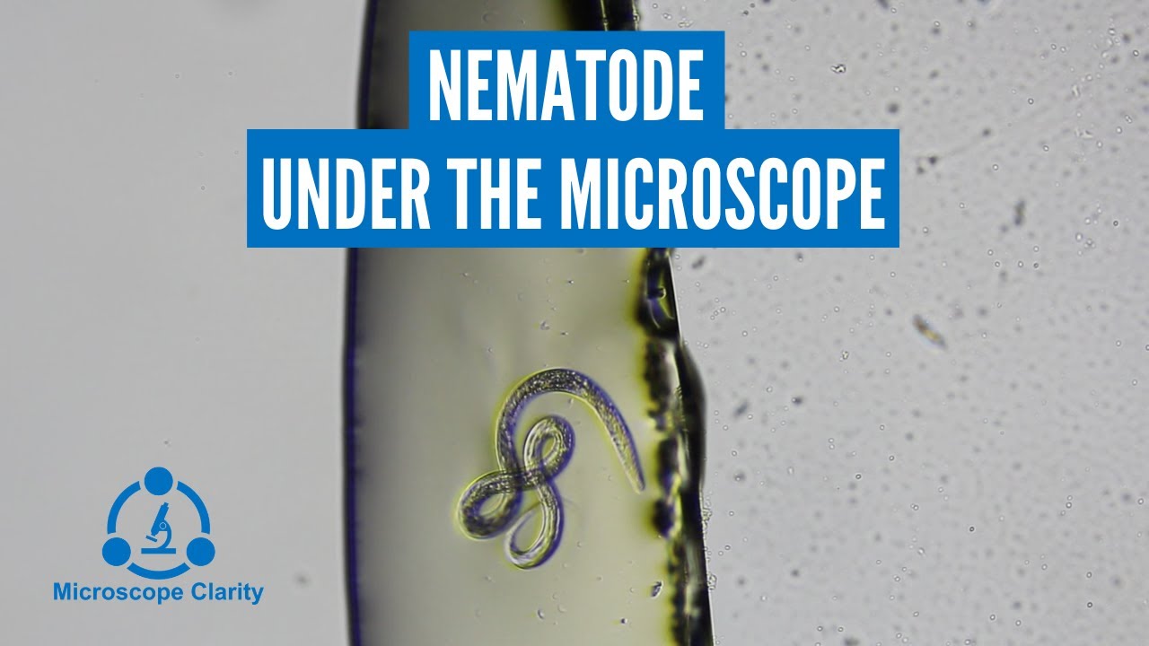 Nematode (Turbatrix) under the microscope! - YouTube