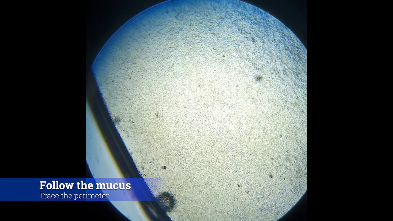 How to Choose and Use a Microscope for Koi Parasite Identification ...