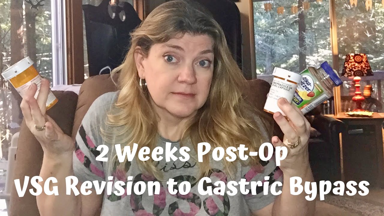 2 Week Post-Op Revision! VSG to RNY || Energy / Complications ...