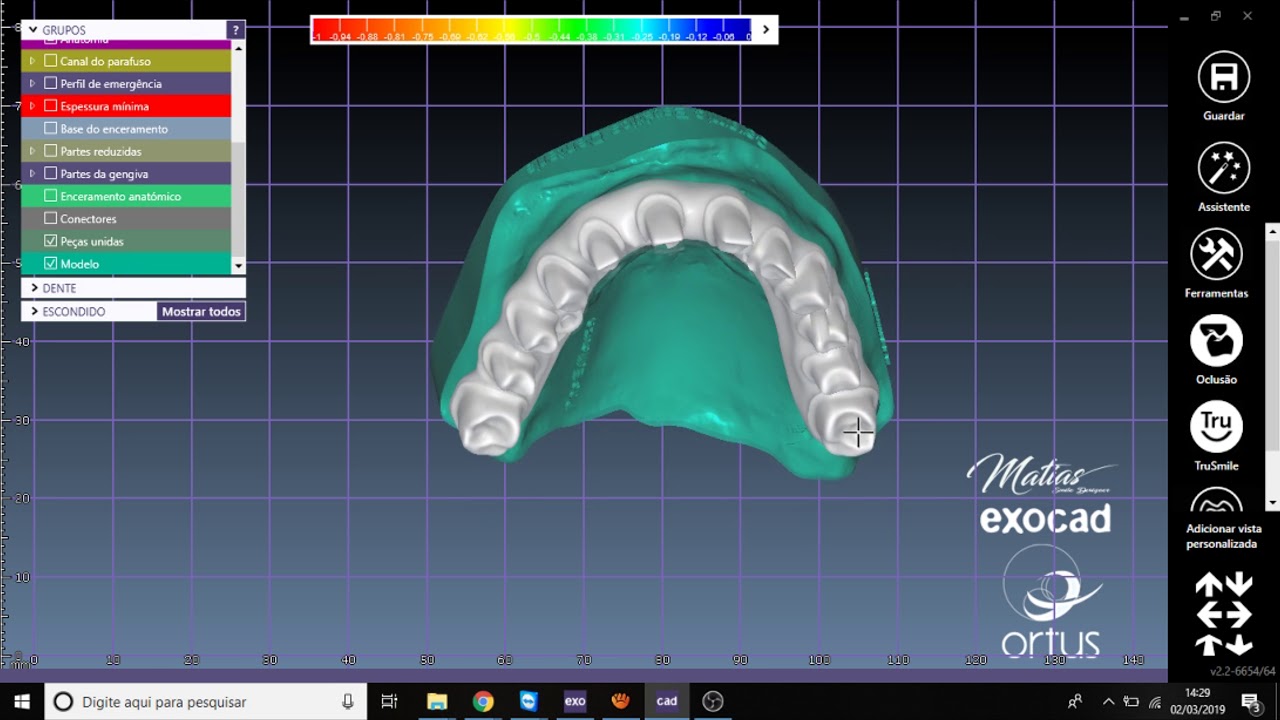 exocad protocolo dente a dente. - YouTube