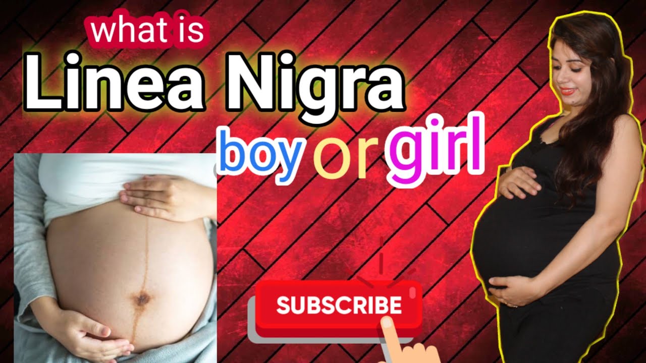 Gender Prediction by belly line? Linea Nigra | प्रेगनेंसी में पेट पर ...