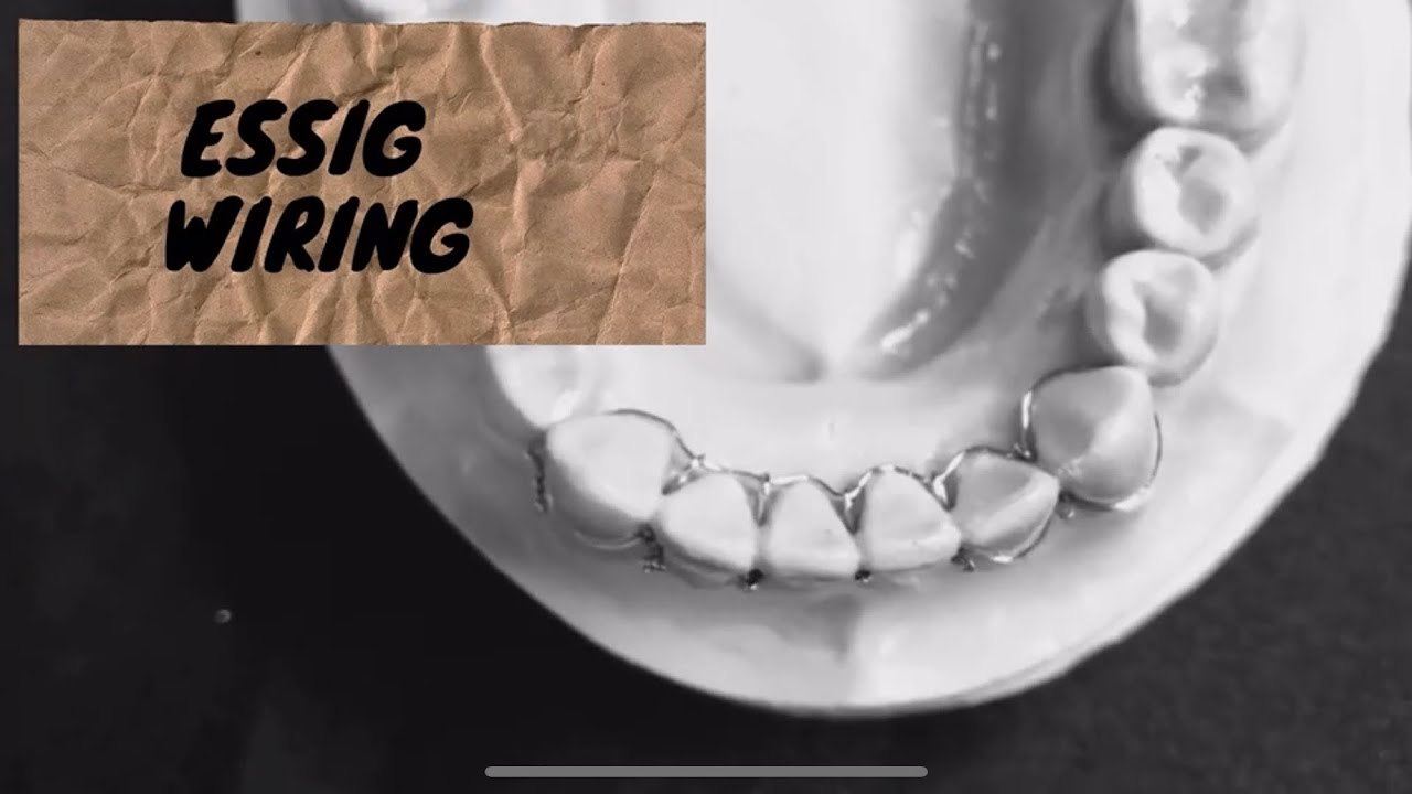 Splinting Essig & Stout (Livica Sanggra Dewi Yanna/1702551004) - YouTube