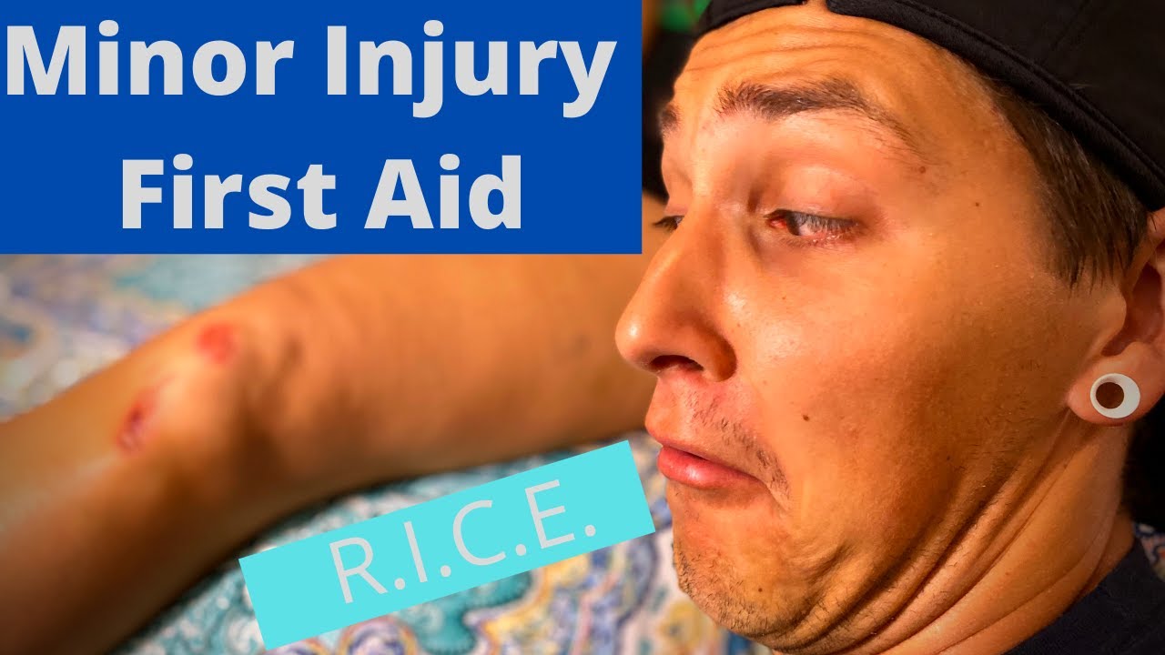 (Minor Injury First Aid) - The R.I.C.E. Method - YouTube