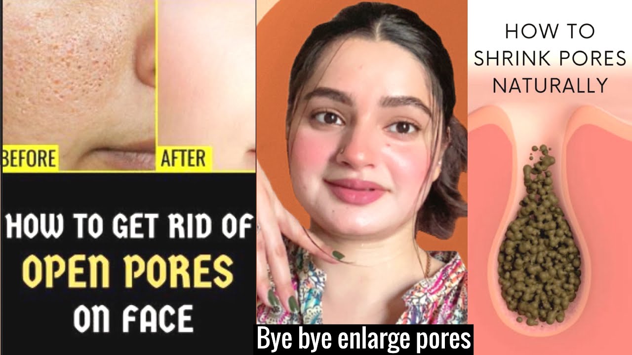 How to minimise OPEN PORES | HOW TO SHRINK OPENING PORES permanently ...