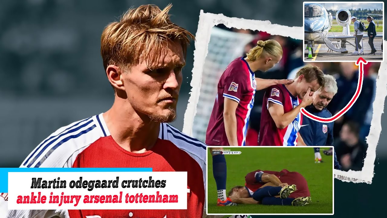 Sport News: GAARD'S UP Arsenal star Martin Odegaard spotted on crutches ...
