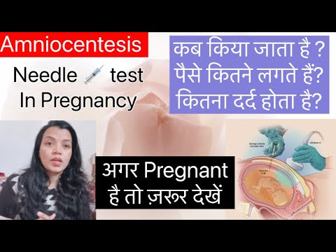 Amniocentesis/needle test pregnancy🤰🏻में कैसे किया जाता है/मेरी high ...