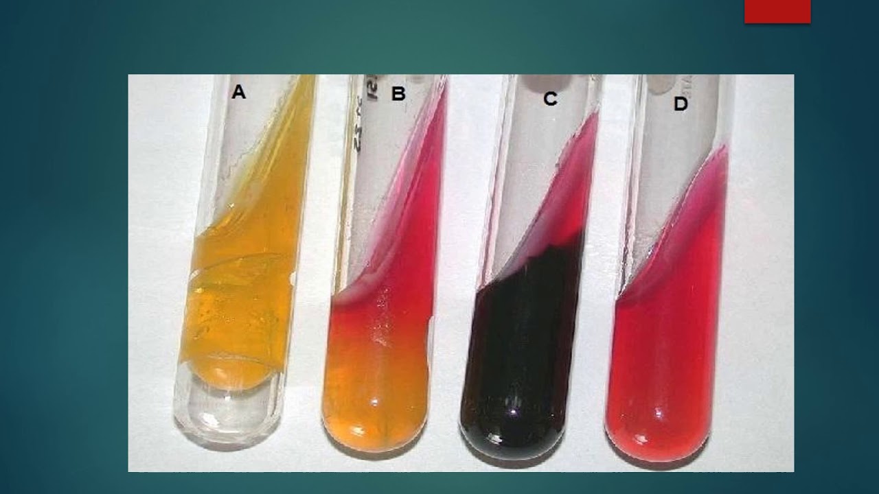 BACILOS GRAM NEGATIVOS - YouTube