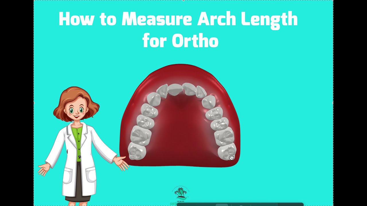 How to Calculate Arch Length Discrepancy - YouTube