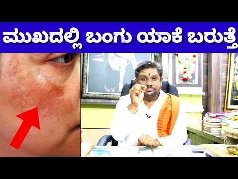 ಮುಖದ ಮೇಲೆ ಬಂಗು ಇರುವವರು ಈ ವಿಡಿಯೋ ನೋಡಿ | Pigmention in Face | Vasudevan | Newz Alert