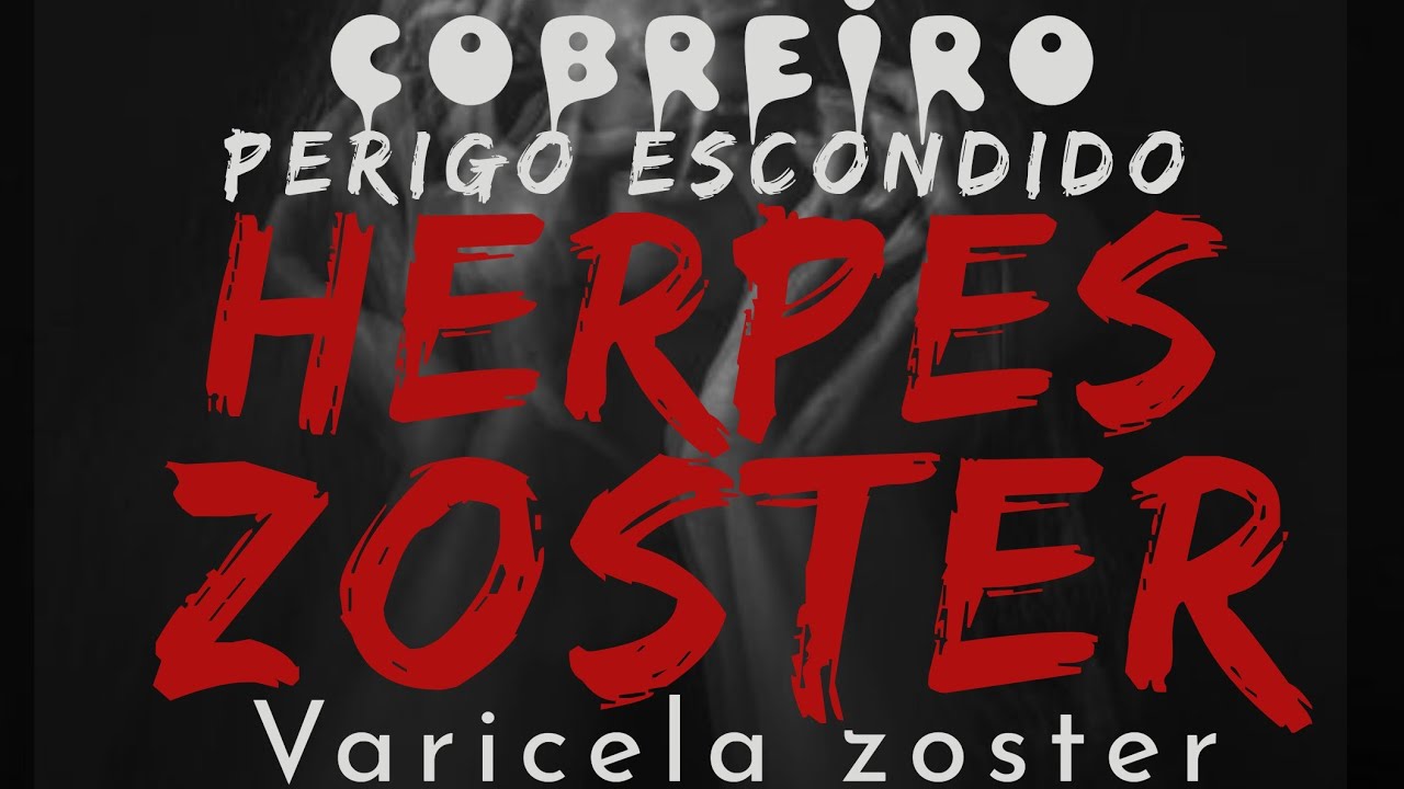 O que é Herpes-zoster? Cobreiro, Causas, sintomas, tratamento. - YouTube