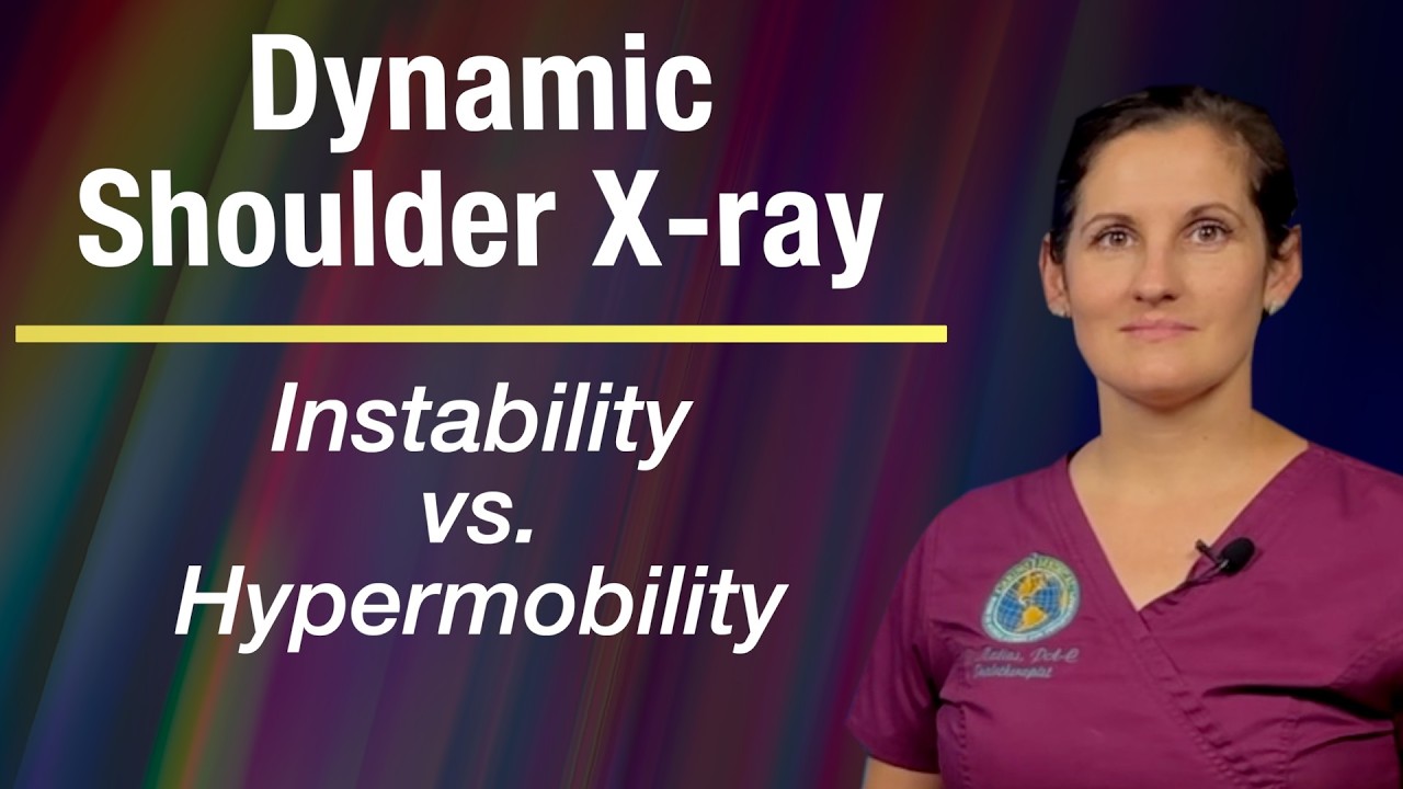 Dynamic imaging helps identify shoulder instability vs. hypermobility ...